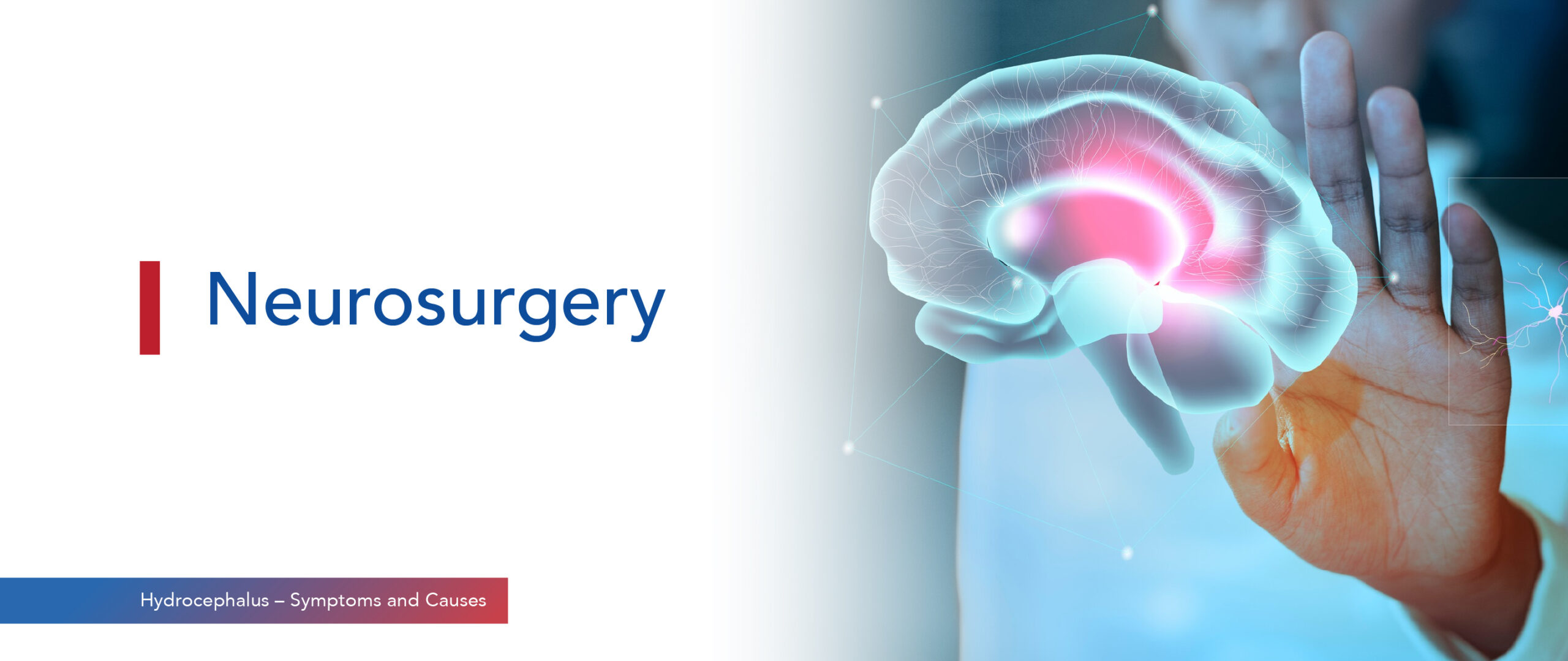 Hydrocephalus: Symptoms and Causes | SPARSH Hospital