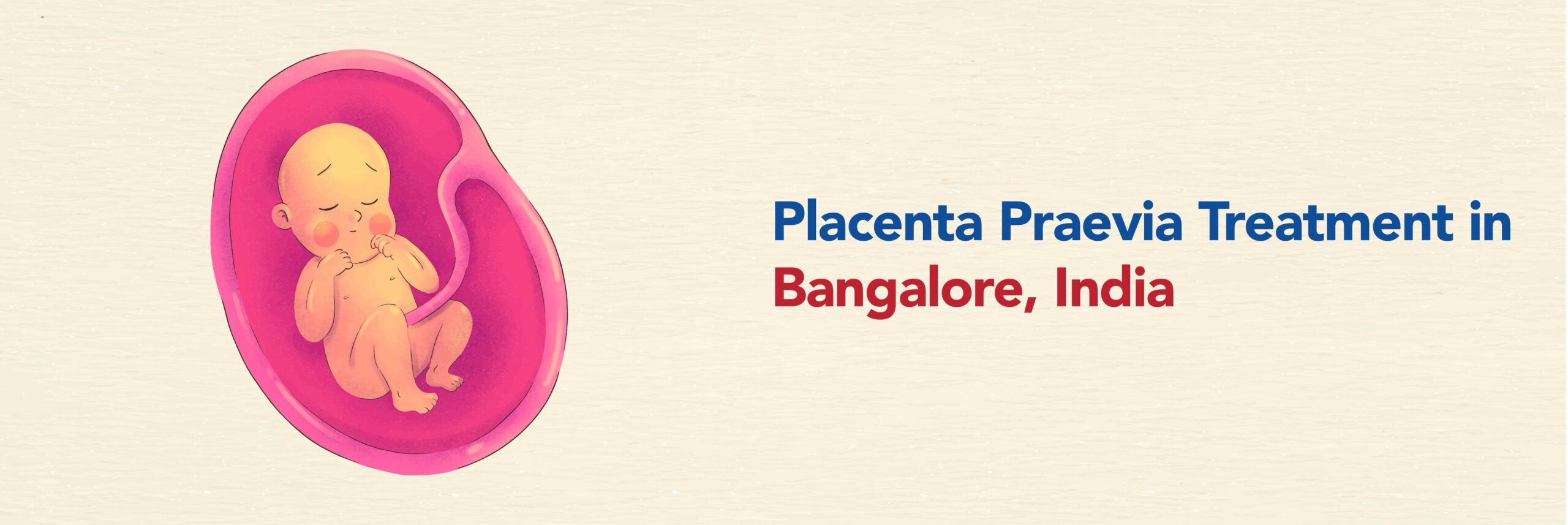 Placenta Praevia Treatment in Bangalore | SPARSH Hospital